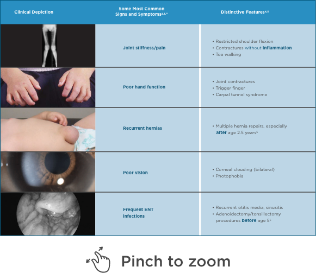 DIFFERENTIATING MPS I